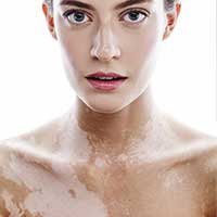 Book an Appointment - Dr Sunil Kothiwala | SkinEva Hospital