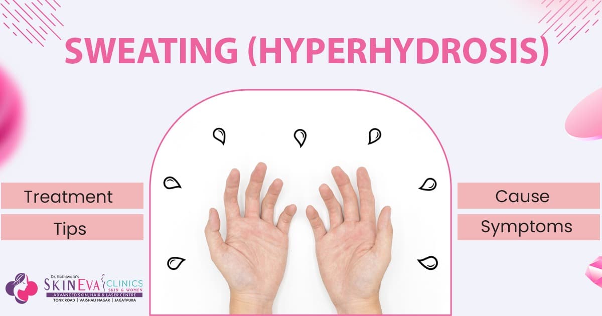Hyperhidrosis /sweaty palms treatment in Jaipur, excessive sweating cure