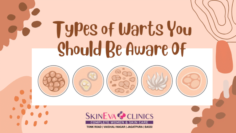 Types of Warts You Should Be Aware Of